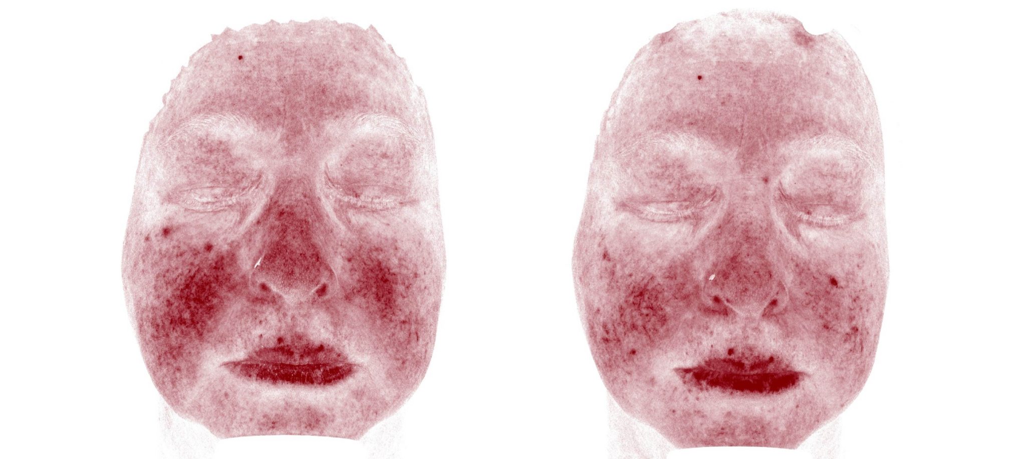 Menopausal Skincare with Seaweed: From Hormonal Shifts to Radiant Skin